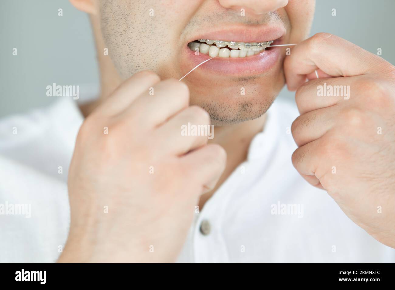Handsome young man with braces cleaning his teeth with dental floss Stock Photo - Alamy