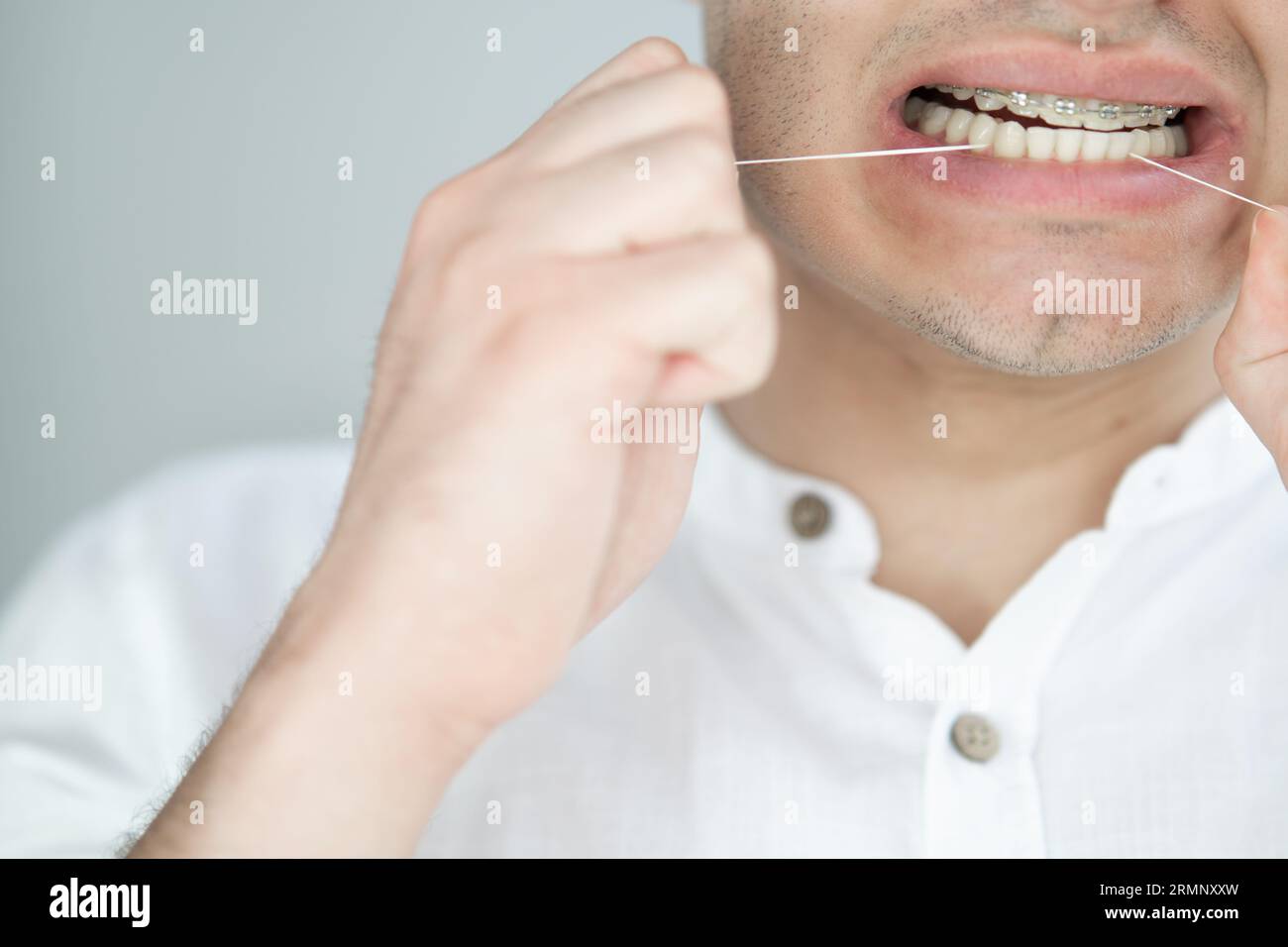 Handsome young man with braces cleaning his teeth with dental floss Stock Photo - Alamy