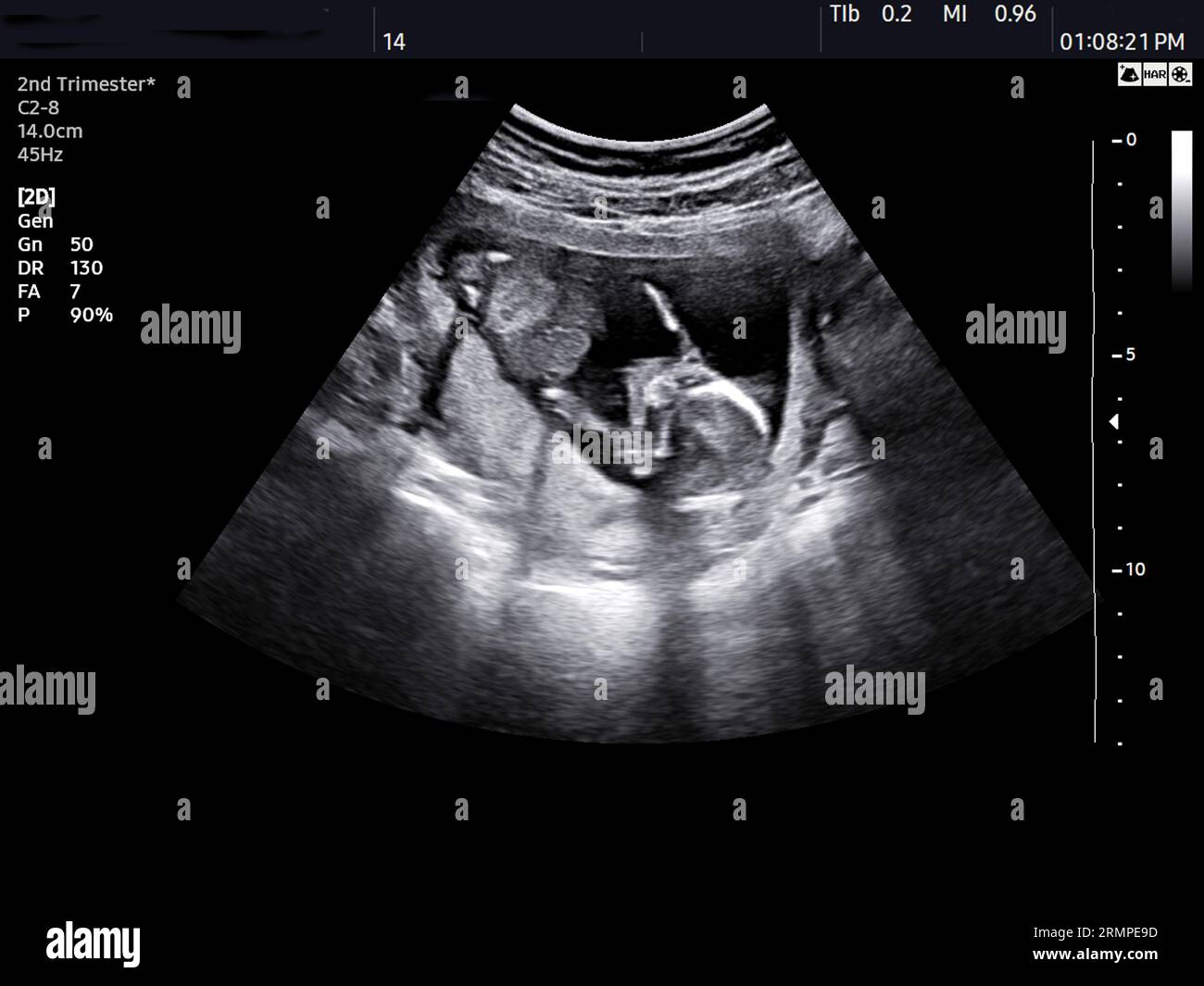 Foetus at 14 weeks, ultrasound scan Stock Photo - Alamy