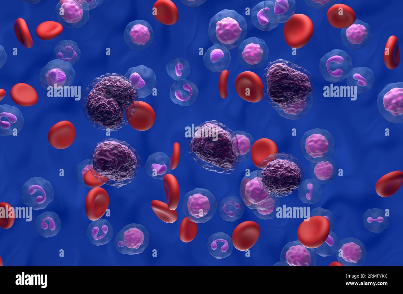 Non-hodgkin lymphoma (NHL) cells in the blood flow - isometric view 3d ...