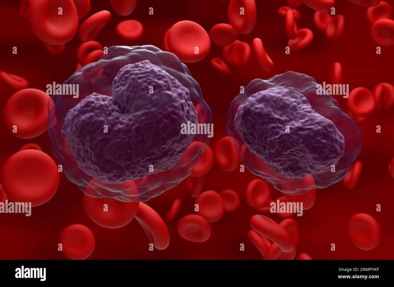Non-hodgkin lymphoma NHL cells in the blood flow - closeup view 3d ...
