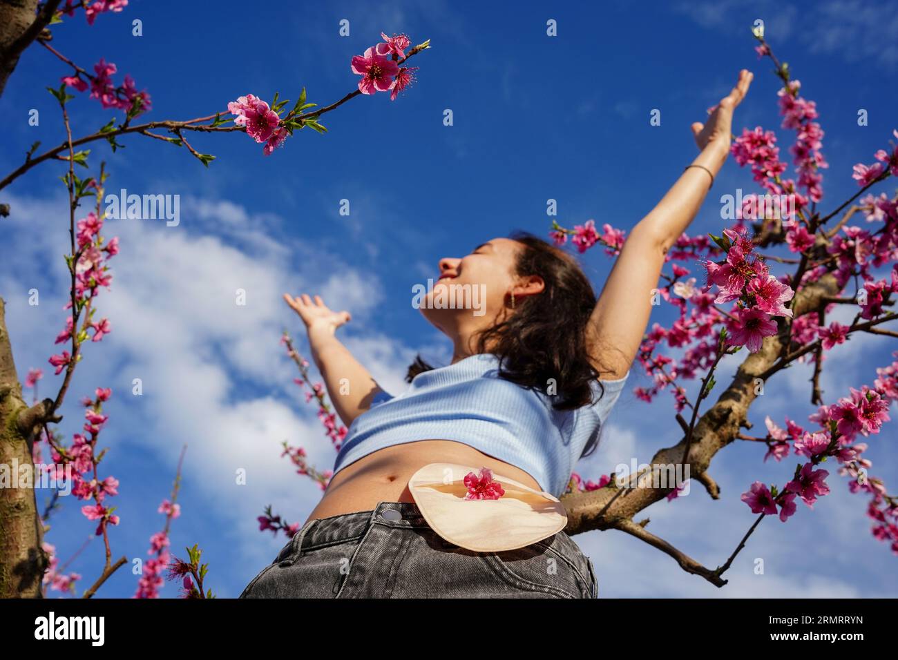 Caucasian girl celebrate World Ostomy Day Stock Photo - Alamy