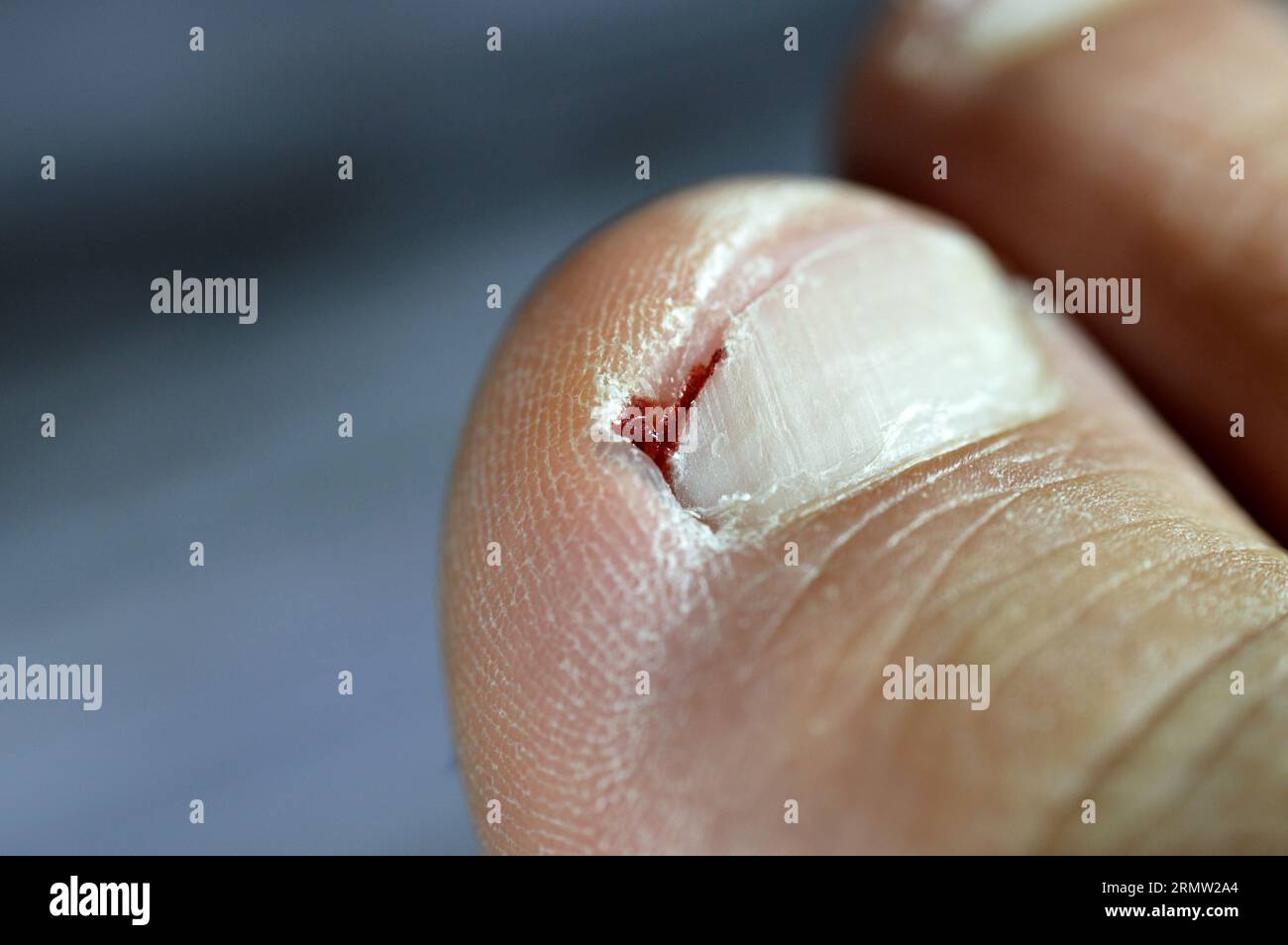 Foot tendons bones hi-res stock photography and images - Alamy