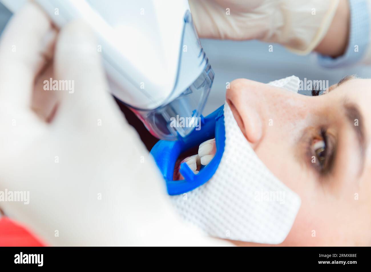 Female receiving teeth whitening procedure Stock Photo - Alamy