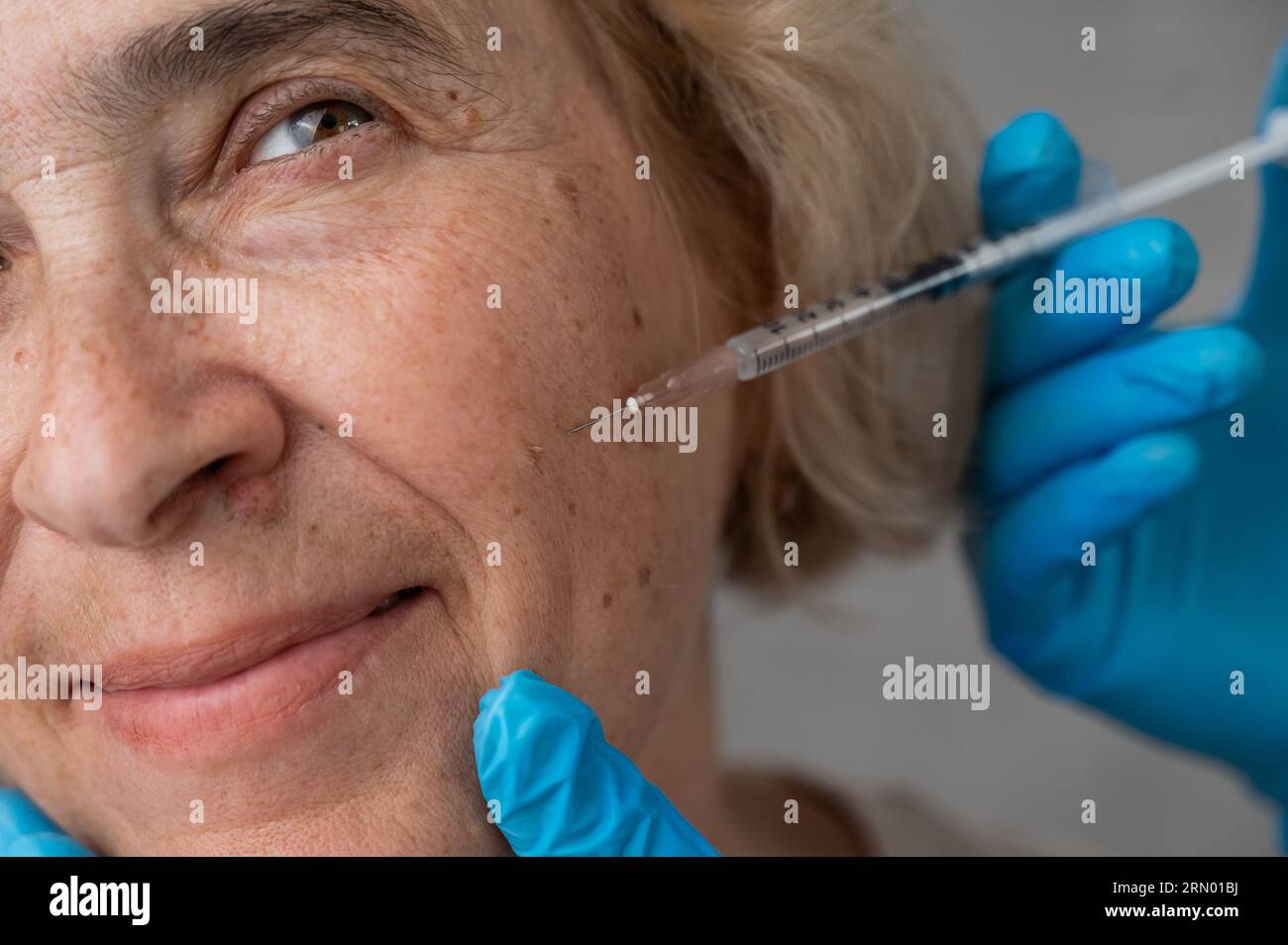 Doctor makes beauty injections in the face of an old caucasian woman ...