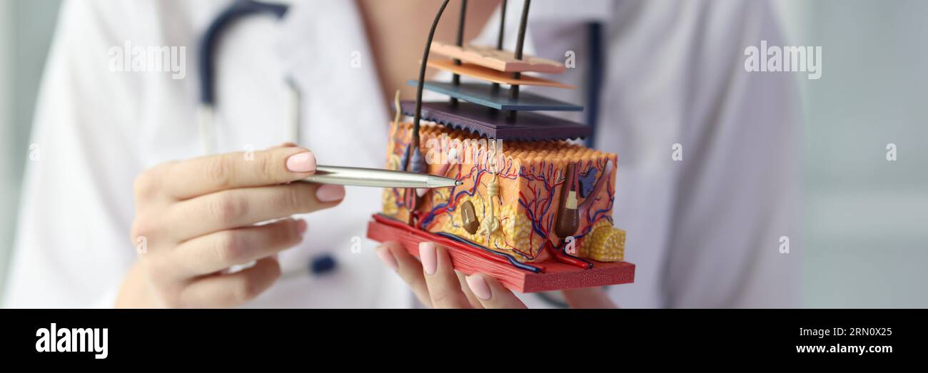 Female dermatologist holding artificial model of human skin with hair ...