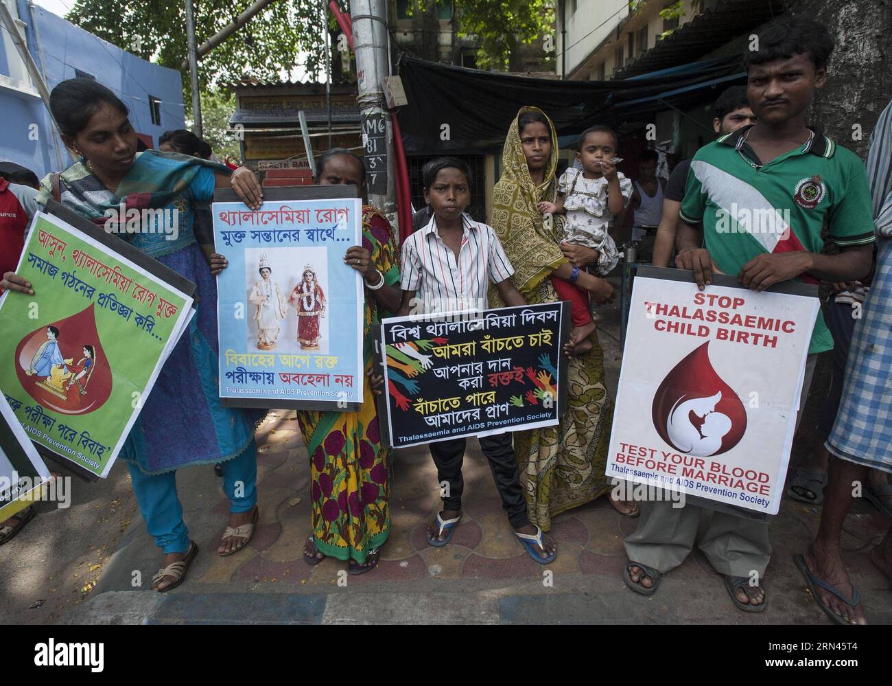 Thalassemia major hi-res stock photography and images - Alamy
