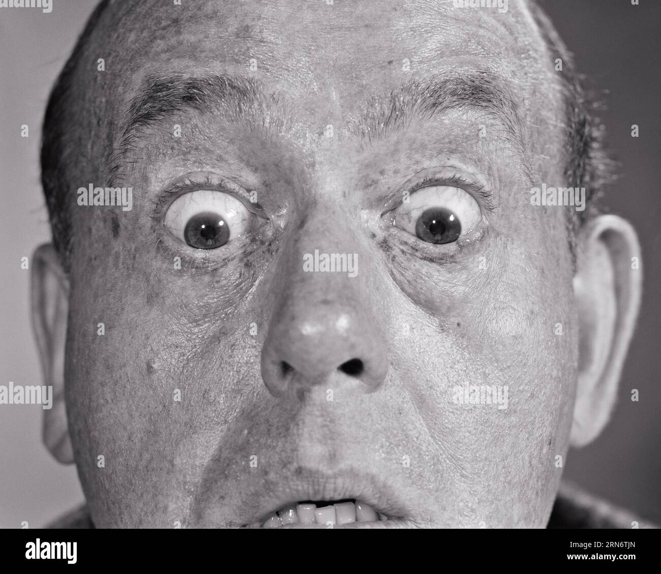 1950s CLOSE-UP PORTRAIT OF MIDDLE-AGED MAN WITH EXTREME BUG-EYED ...