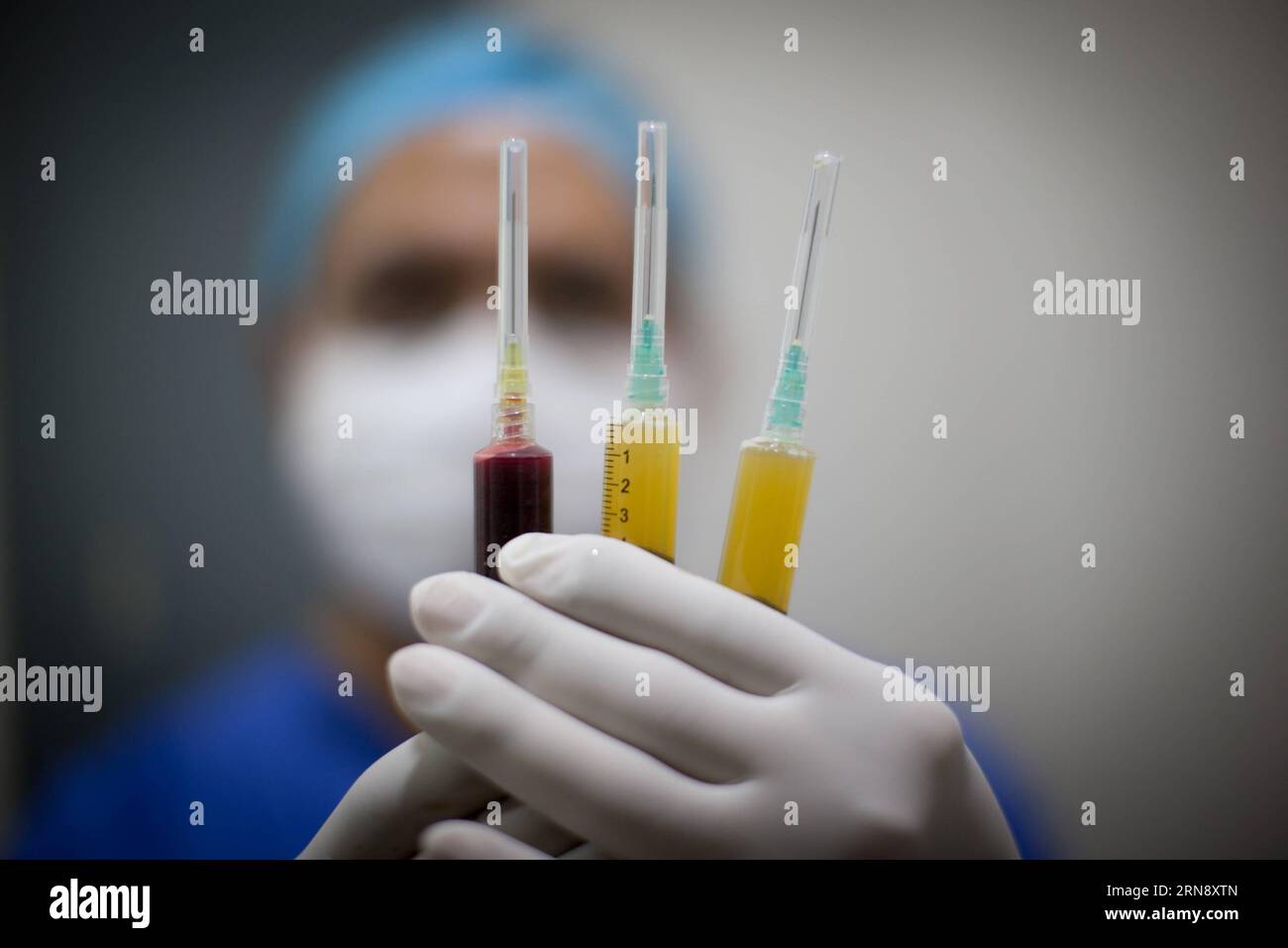 Image taken on Nov. 4, 2015 shows a medic performing the stem cell ...