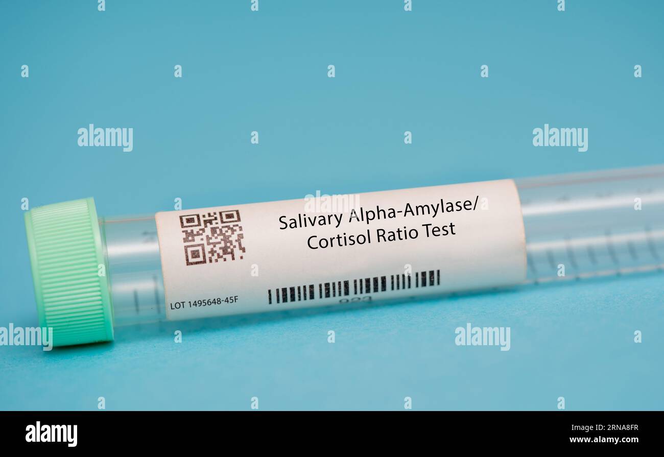 Salivary Alpha-Amylase/ Cortisol Ratio Test This test measures the ... Salivary Alpha-Amylase/ Cortisol Ratio Test This test measures the ...