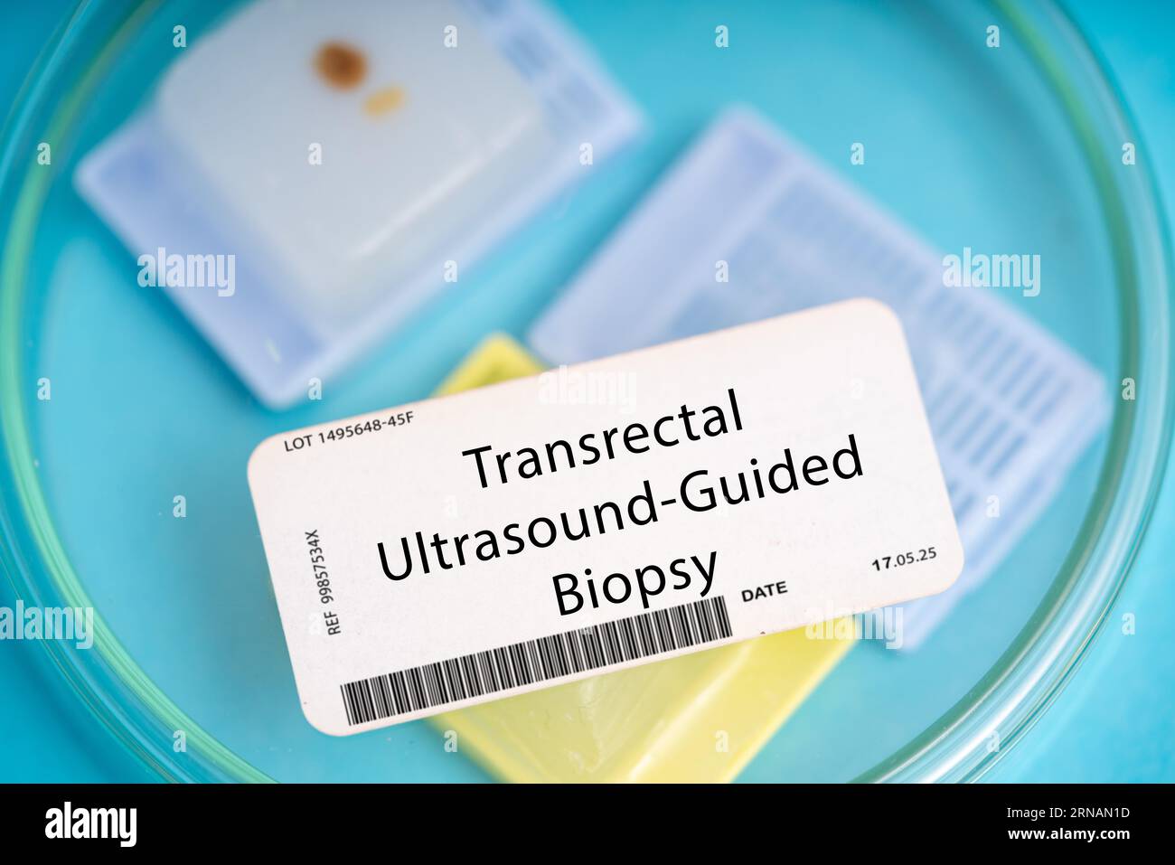 Transrectal Ultrasound Guided Biopsy This Involves The Insertion Of A
