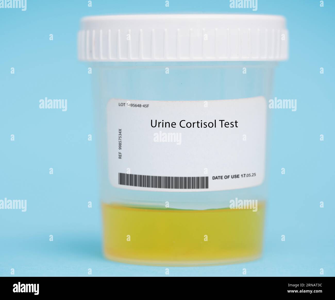 Urine cortisol test This test measures the levels of cortisol, a ...
