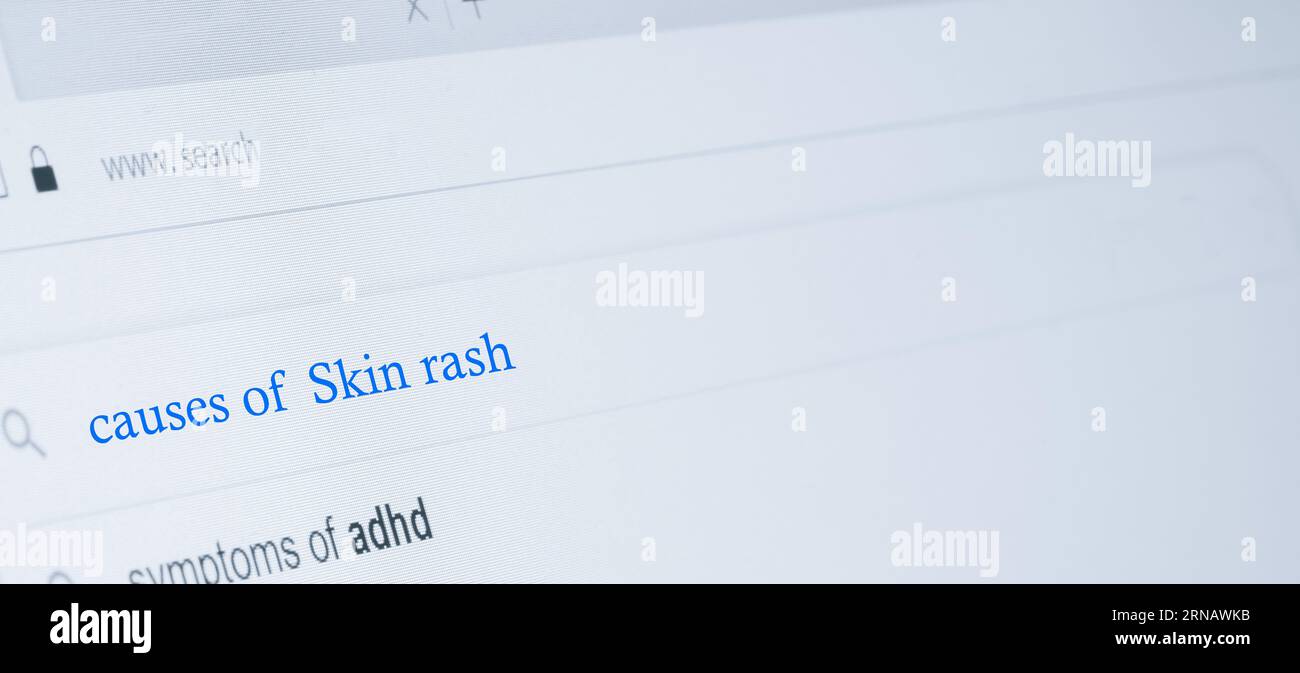 Skin rash search for the cause of malaise on the Internet on a computer ...