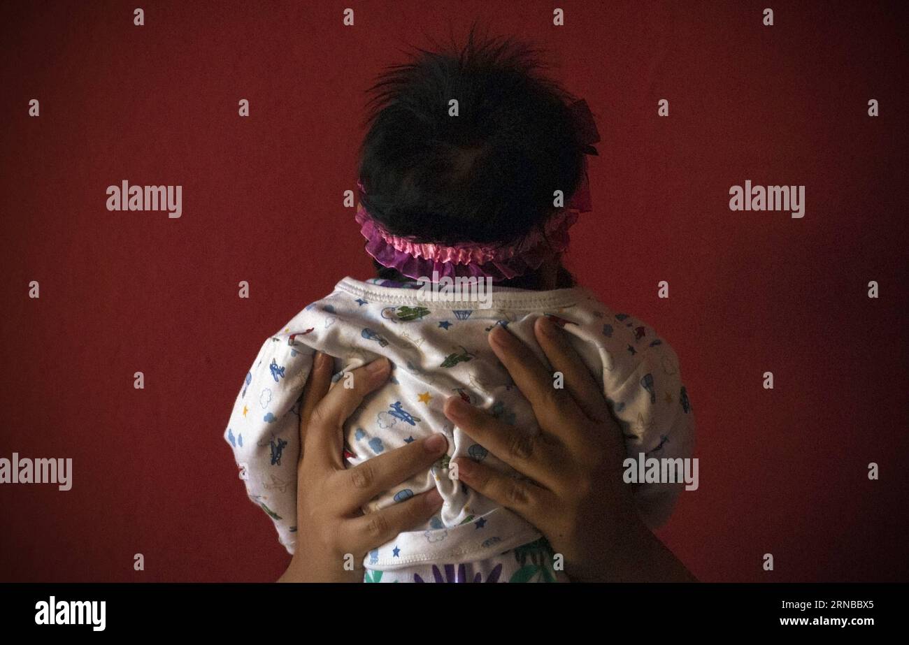 Image taken on Feb. 27, 2016 shows Dominic Andrade, who suffers ...