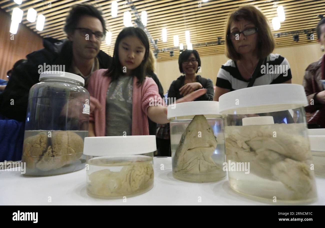 Different types of animal brain specimens are displayed at the Brain ...