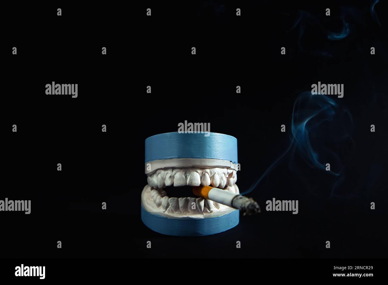Plaster model of the jaw with a cigarette on a black background ...
