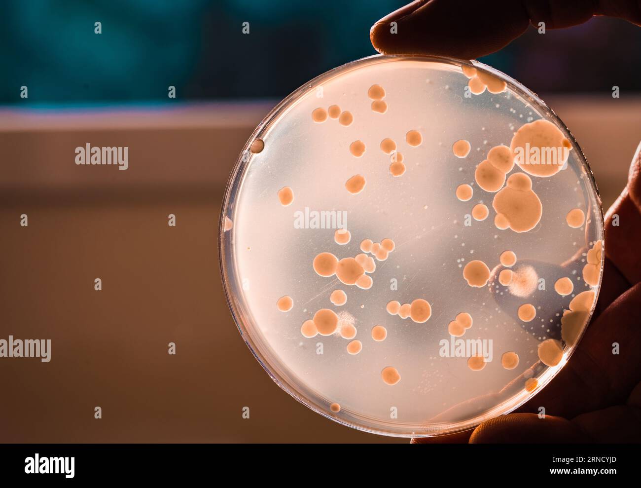 Petri dish with colonies of microorganisms in a medical laboratory ...
