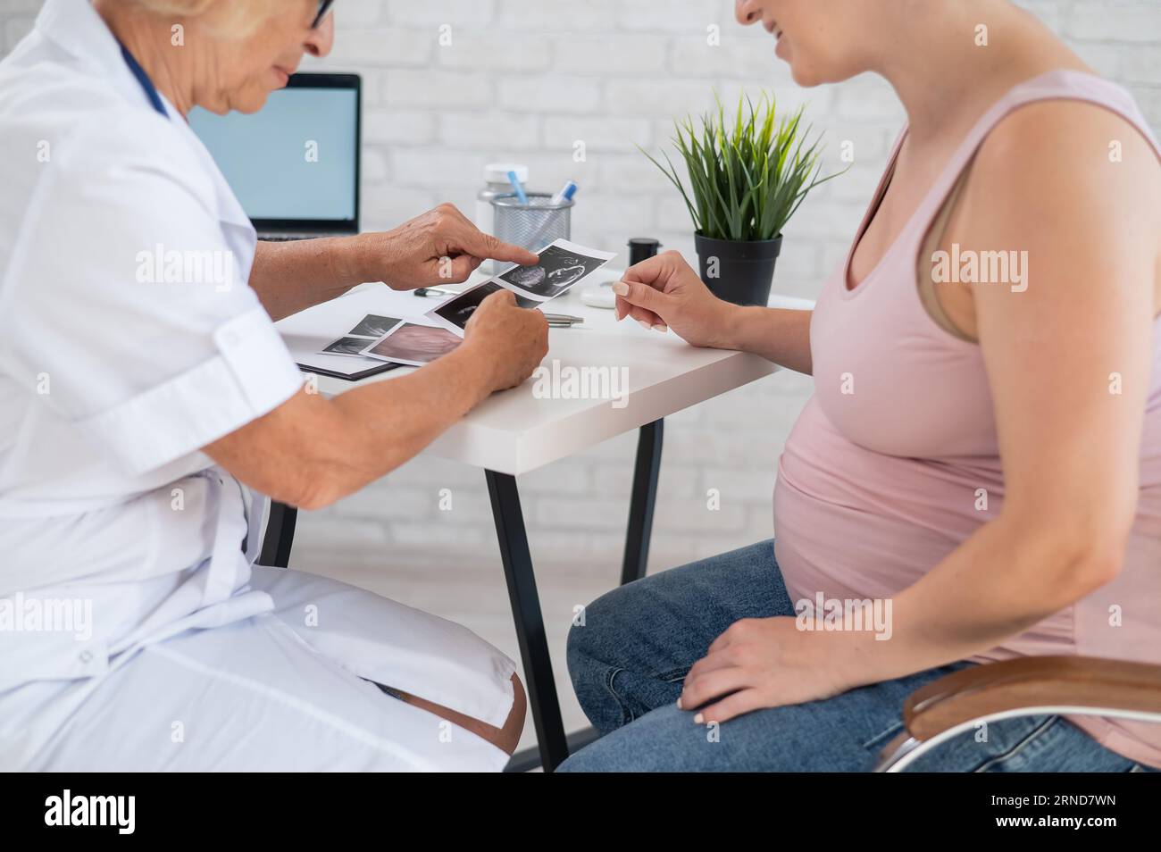 Obstetrician gynecologist explaining the screening picture to a ...