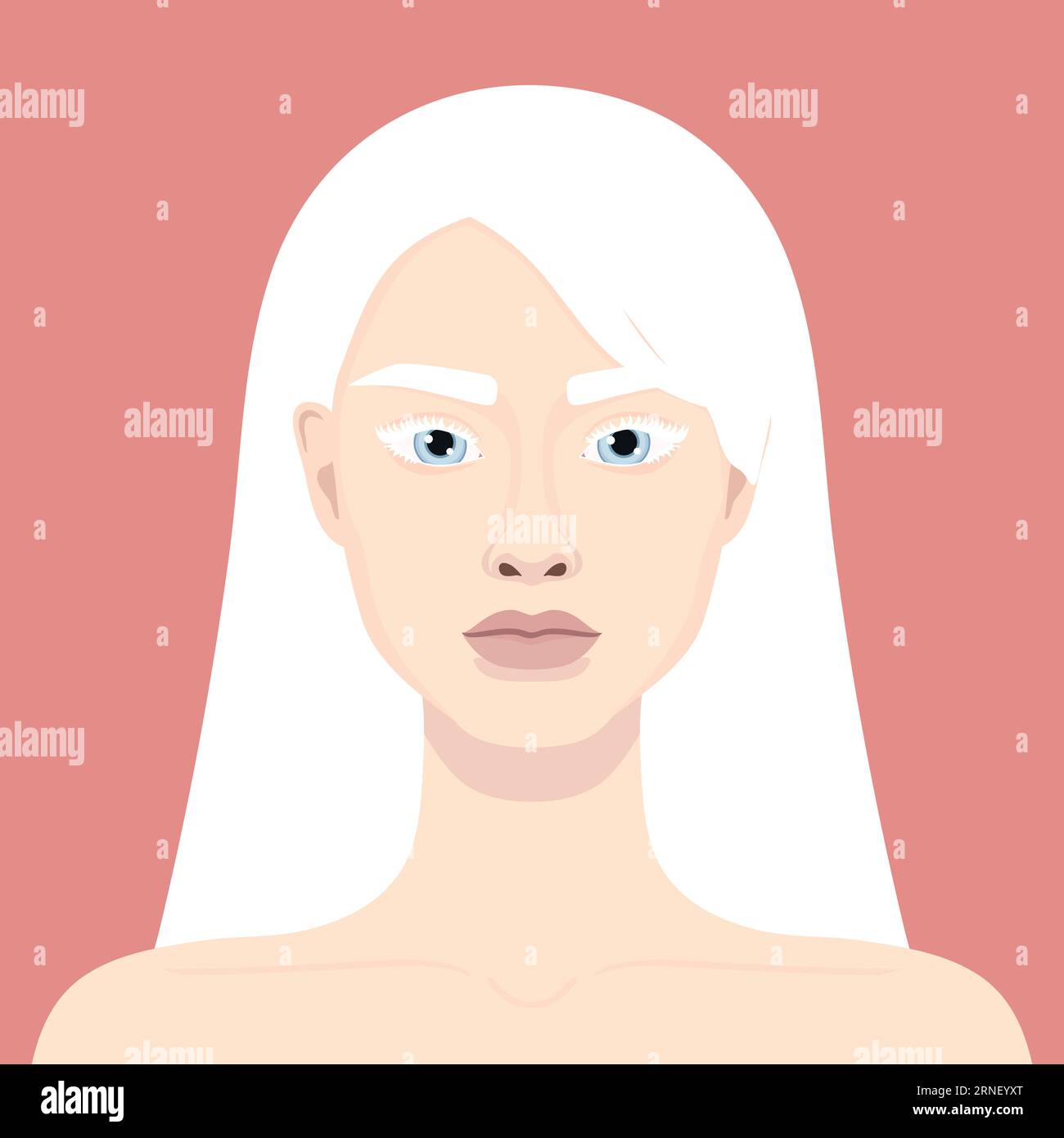 Albino woman portrait. Avatar of a girl with albinism. Genetic rare appearance. Vector ...