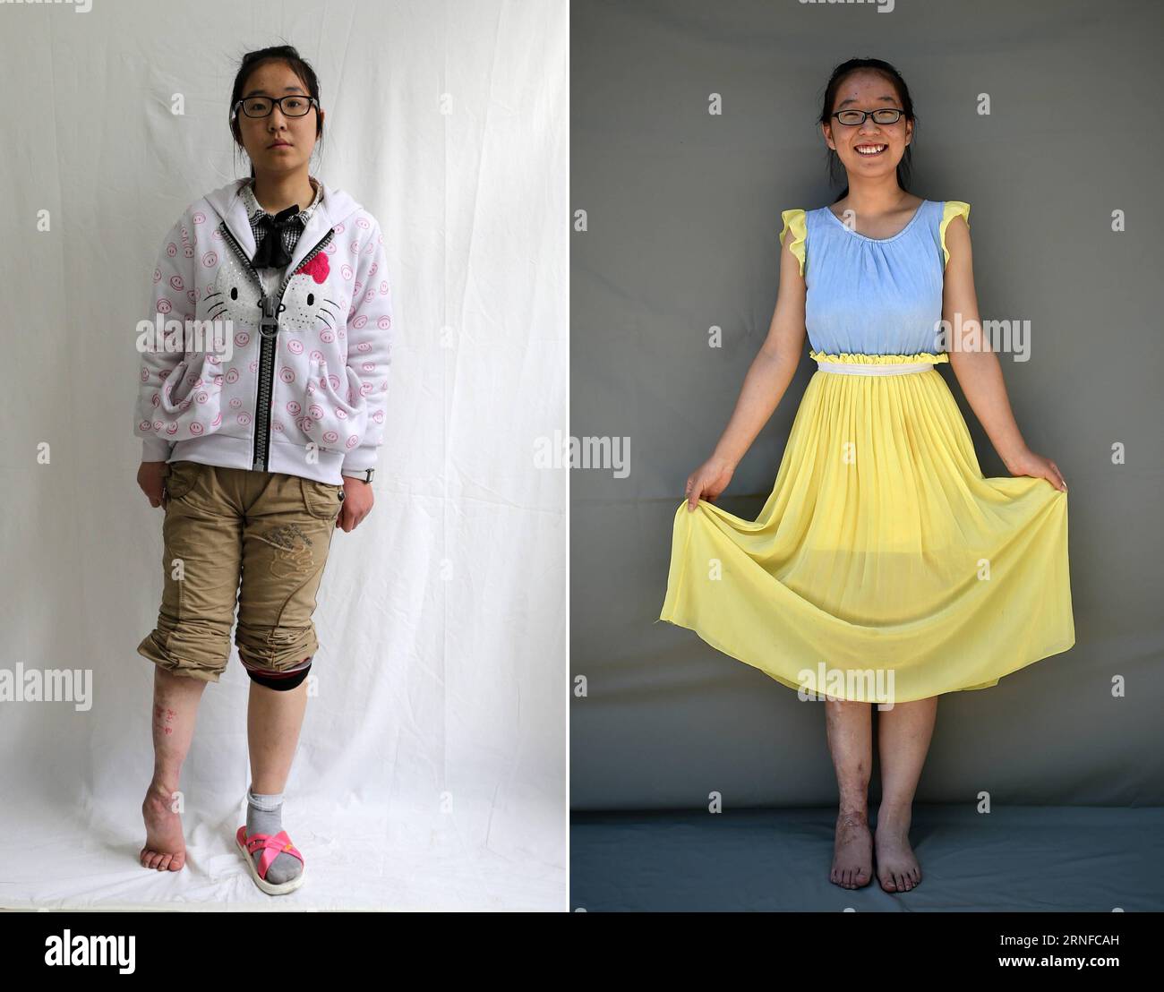 Defect reduction hi-res stock photography and images - Alamy