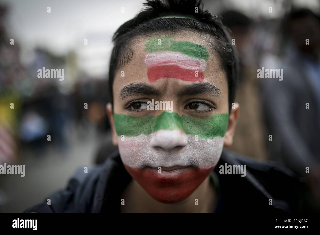 (170210) -- TEHRAN, Feb. 10, 2017 -- An Iranian boy whose face was ...