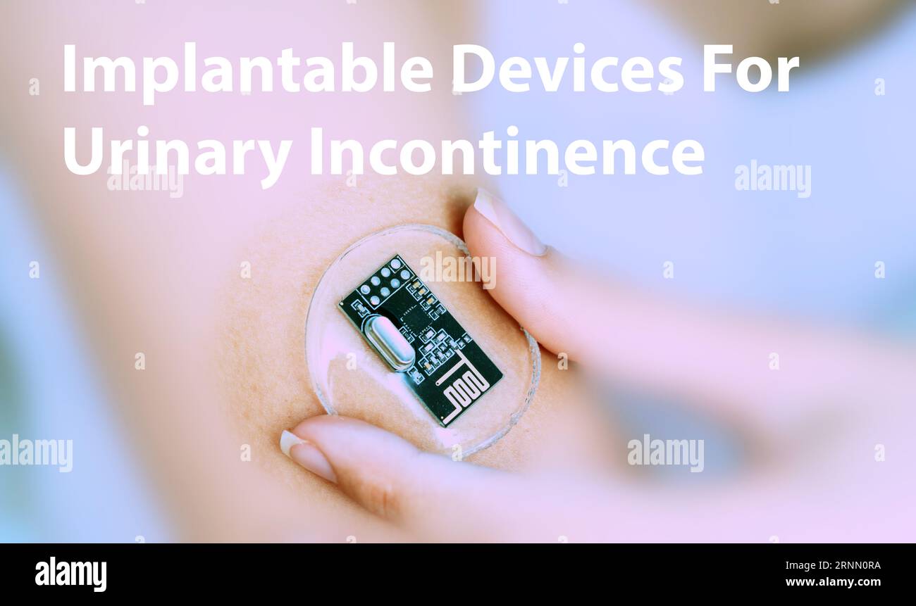 Implantable devices for urinary incontinence: Devices that support ... Implantable devices for urinary incontinence: Devices that support ...