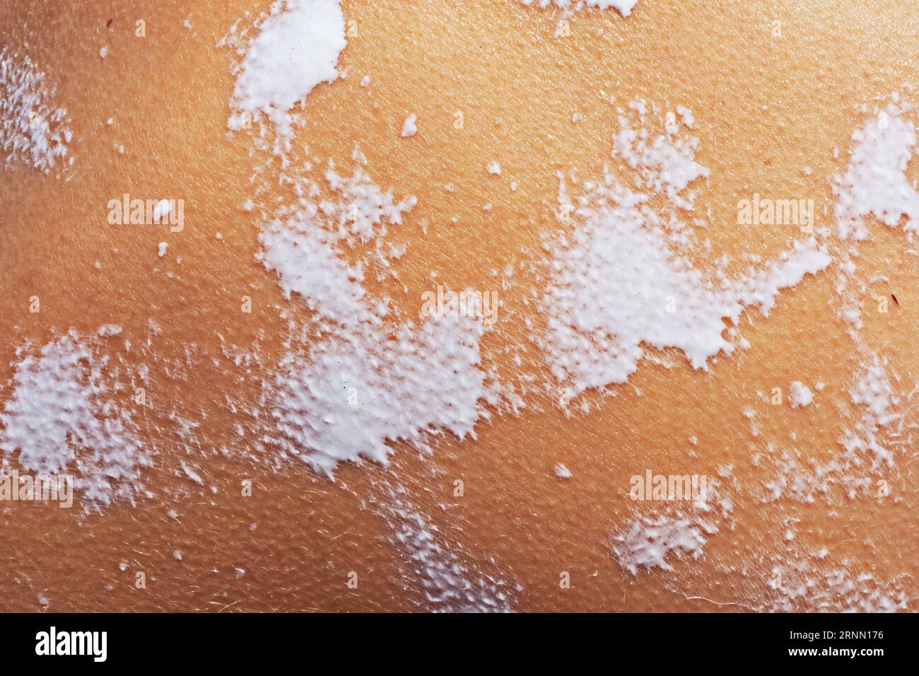 Fair skin hi-res stock photography and images - Alamy