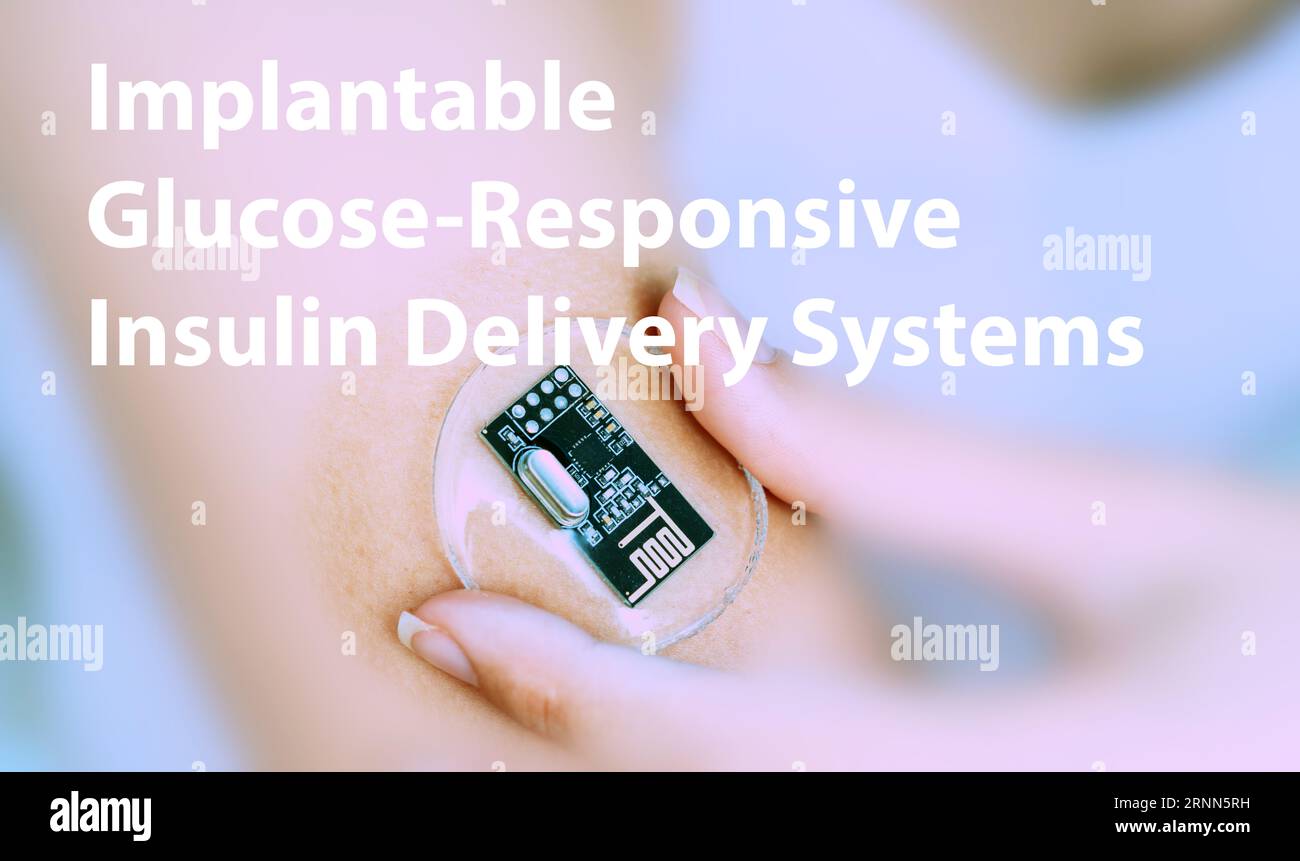 Implantable glucose-responsive insulin delivery systems: Smart implants ...