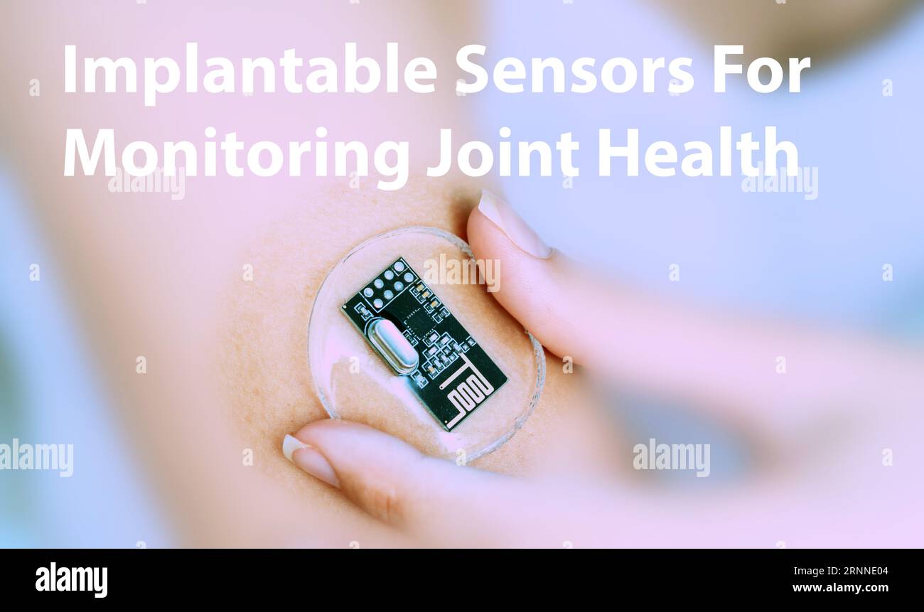 Implantable sensors for monitoring joint health: Devices that measure parameters like pressure ...