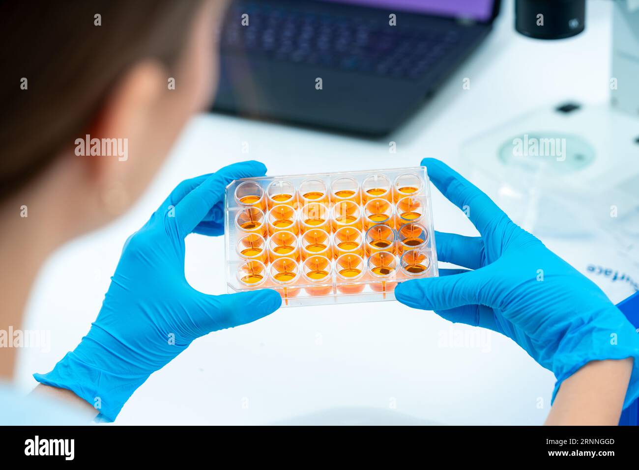 Reporter Assays: Genetic research often involves reporter gene assays ...