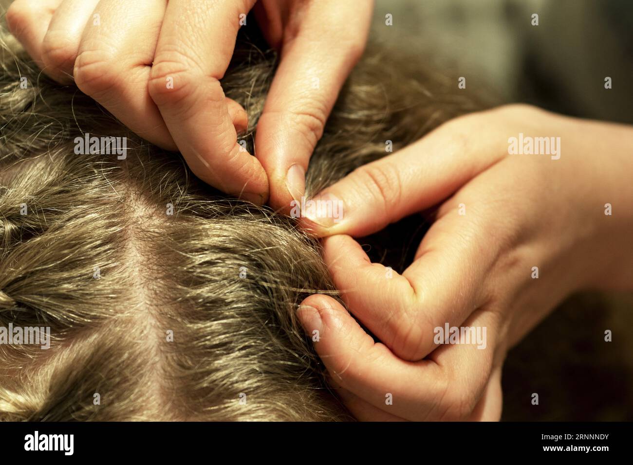 louse on head a girl. women hands checking childs head for lice. Close ...