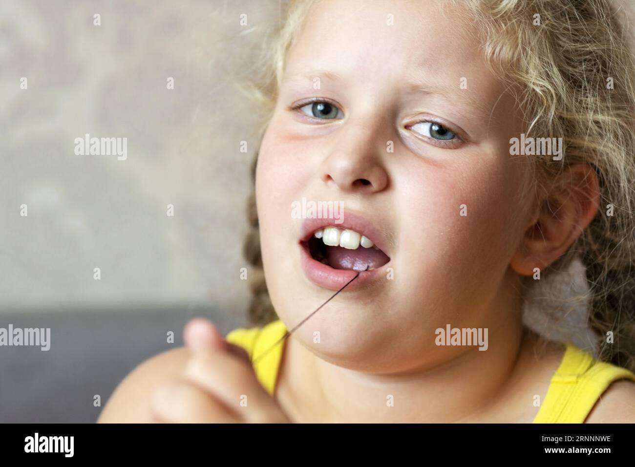 girl holds thread to pull out a milk tooth. Removal of tooth at the ...
