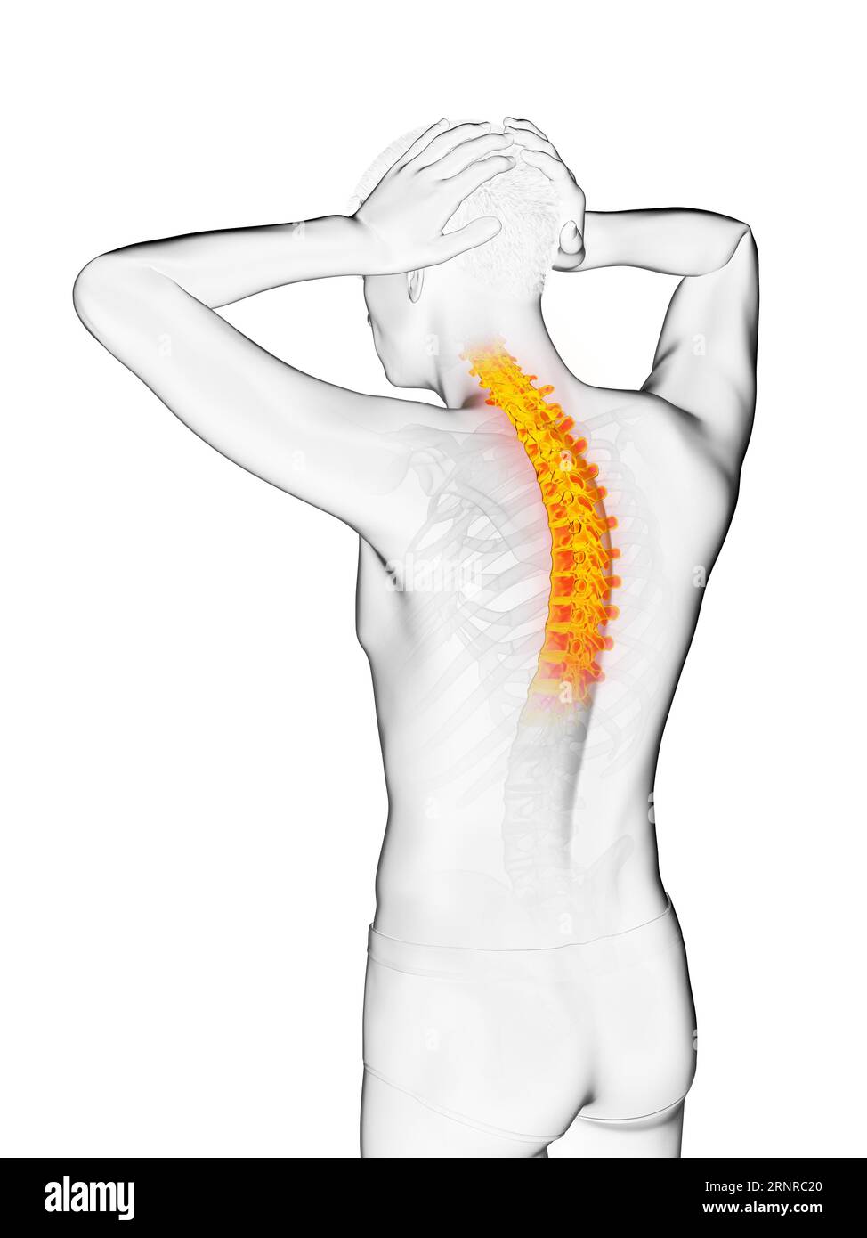 Man with backache, illustration Stock Photo - Alamy