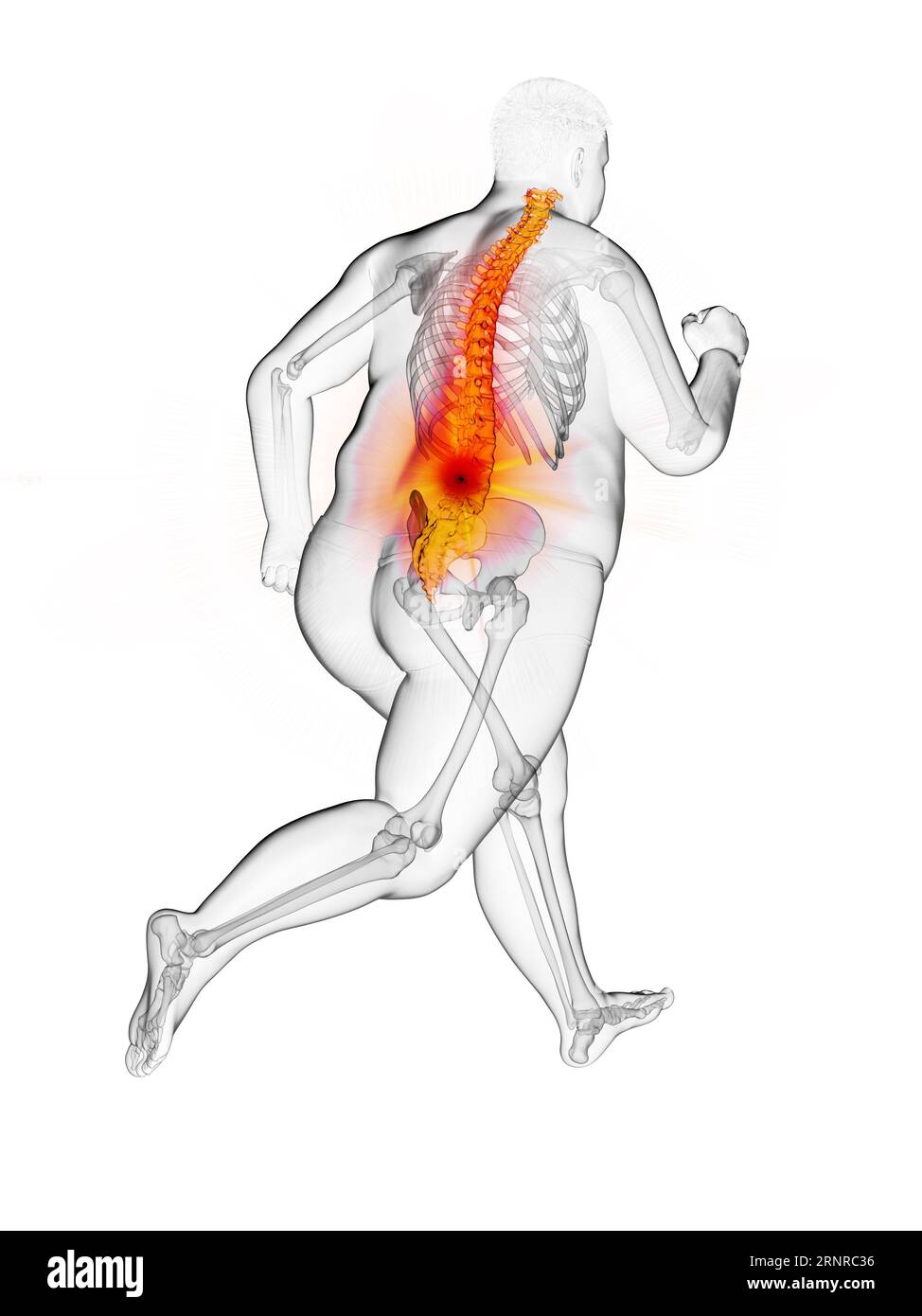 Obese runner's painful back, illustration Stock Photo - Alamy