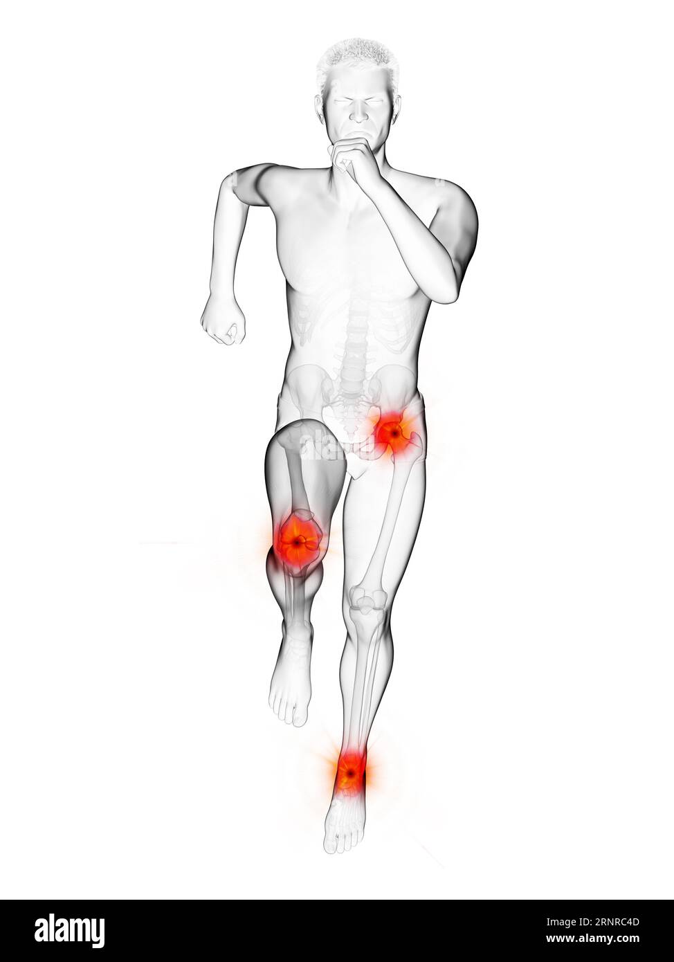 Abnormal knee Cut Out Stock Images & Pictures - Alamy