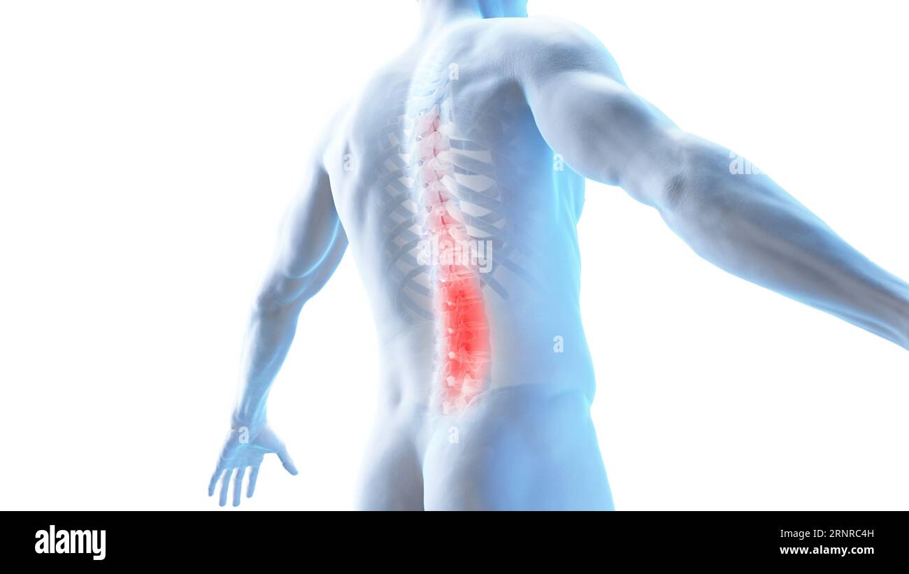 Painful back, illustration Stock Photo - Alamy