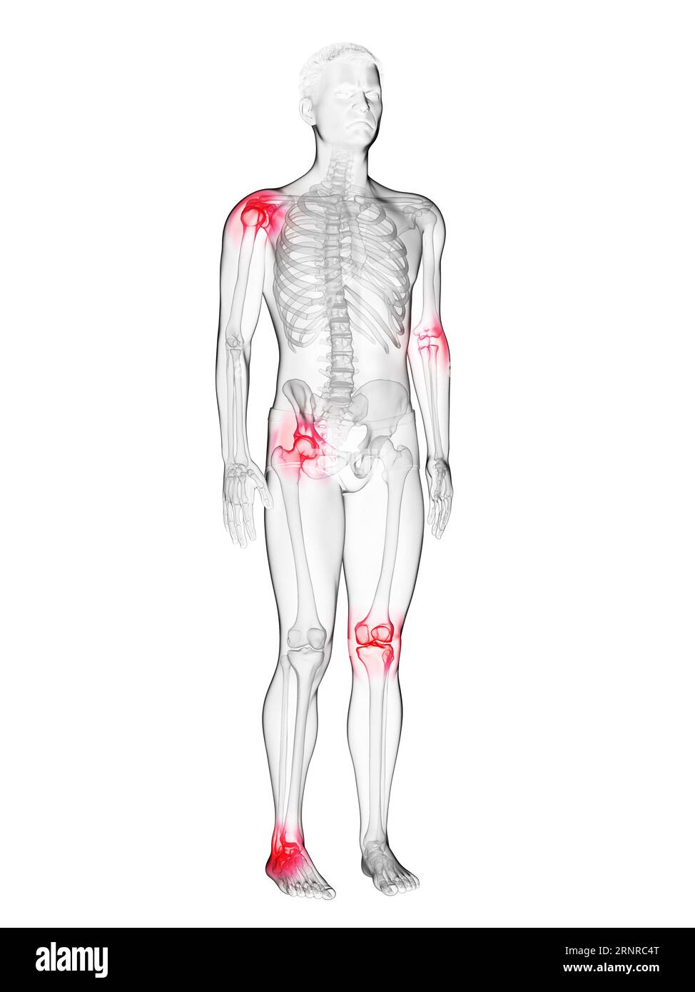 Man's painful joints, illustration Stock Photo - Alamy