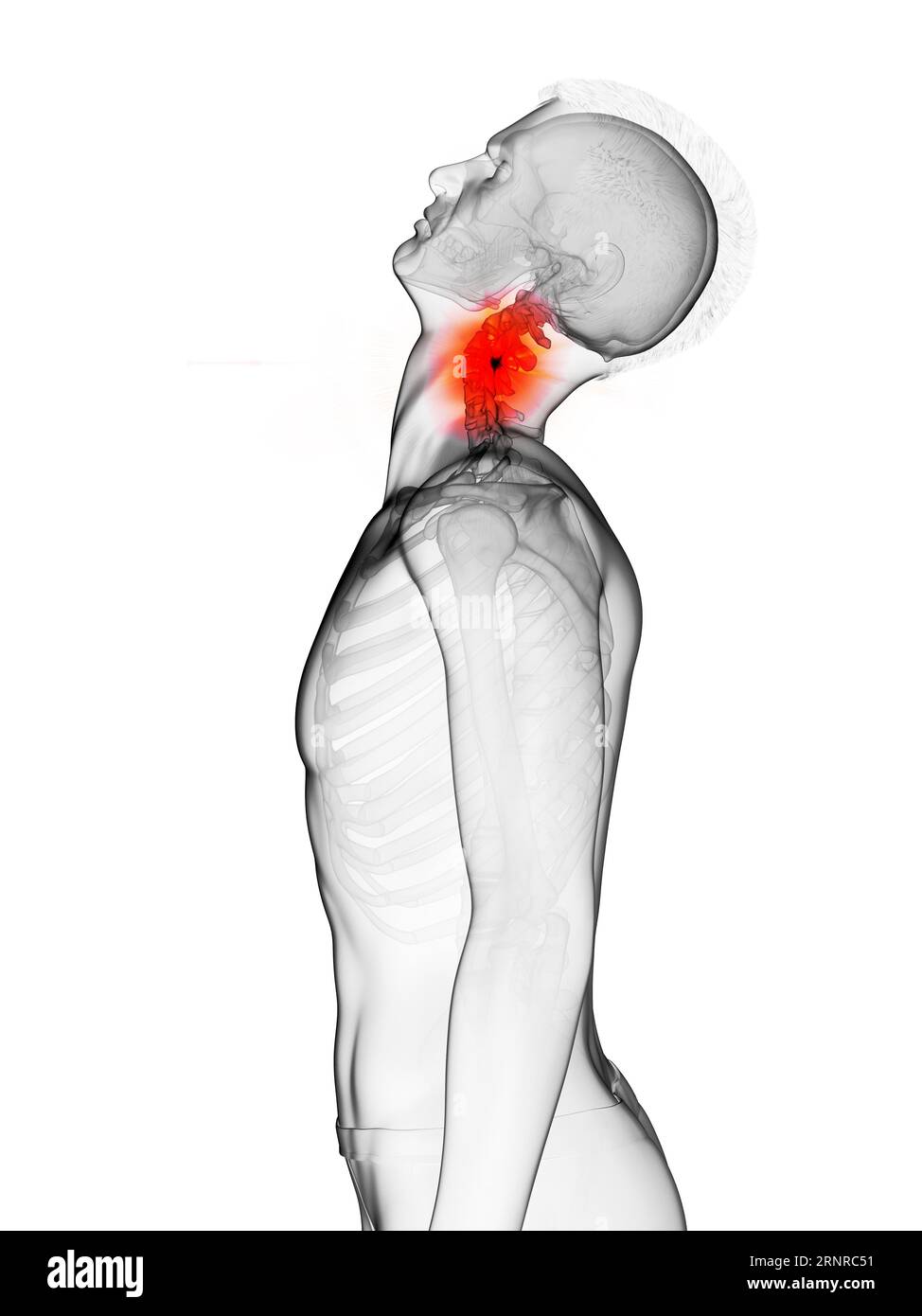 Neck arthritis Cut Out Stock Images & Pictures - Alamy