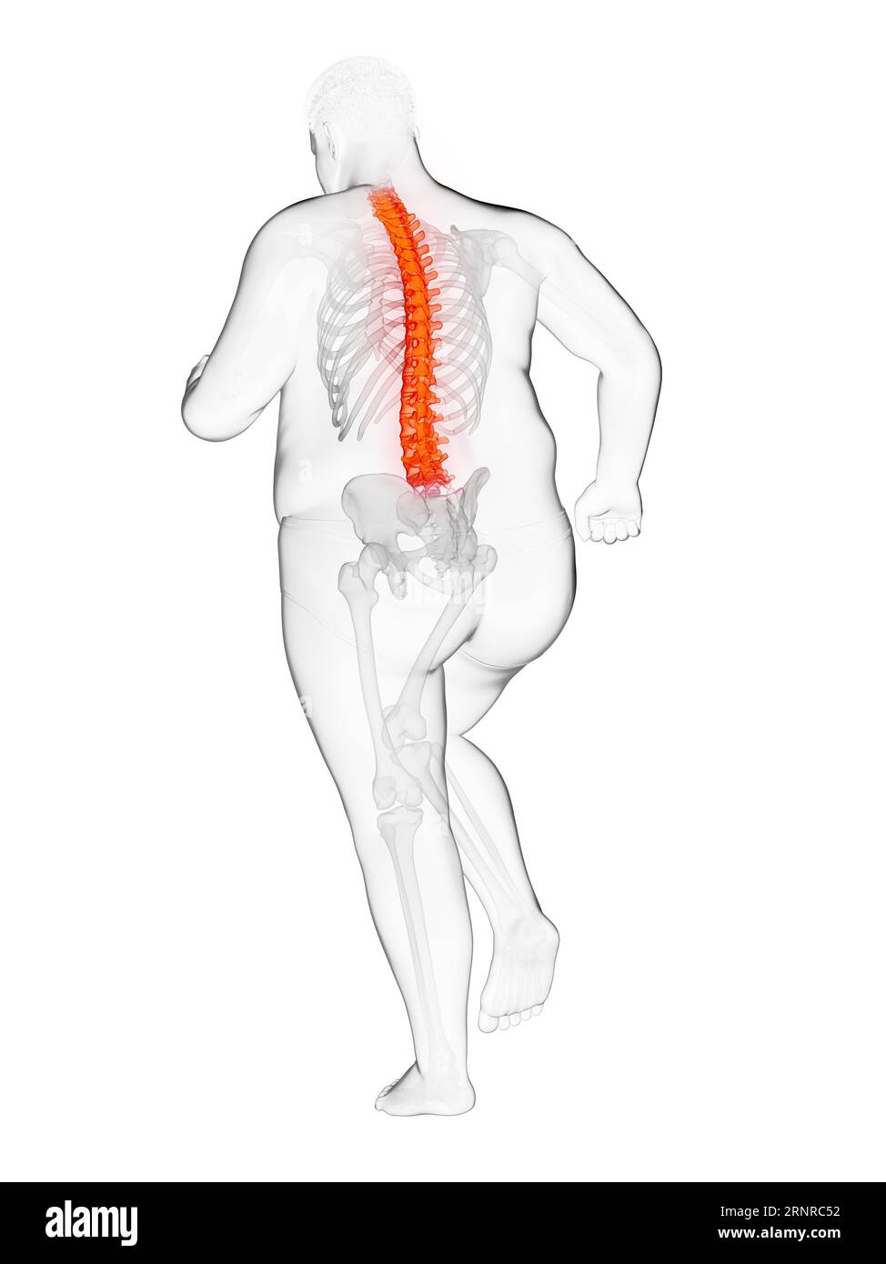 Obese runner's painful back, illustration Stock Photo - Alamy