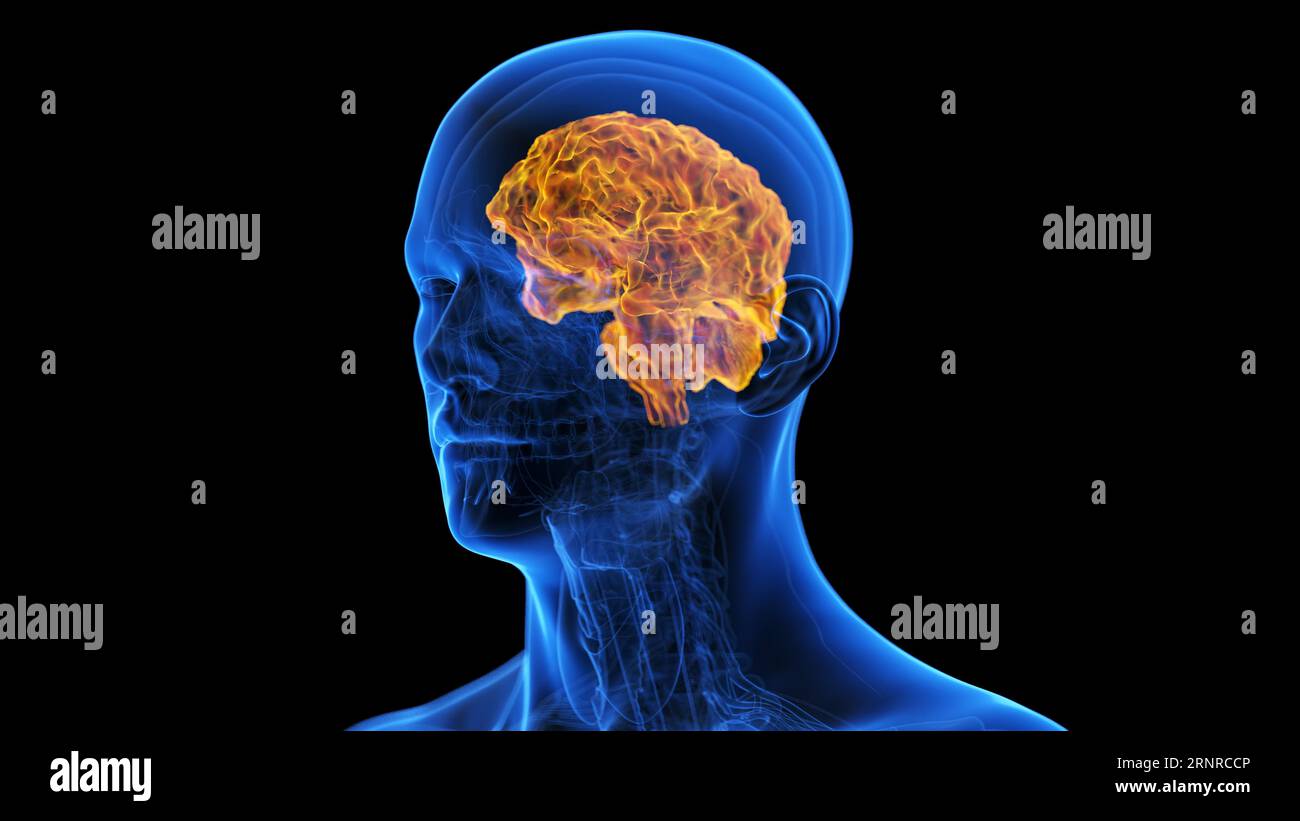 Degenerated human brain, illustration Stock Photo - Alamy