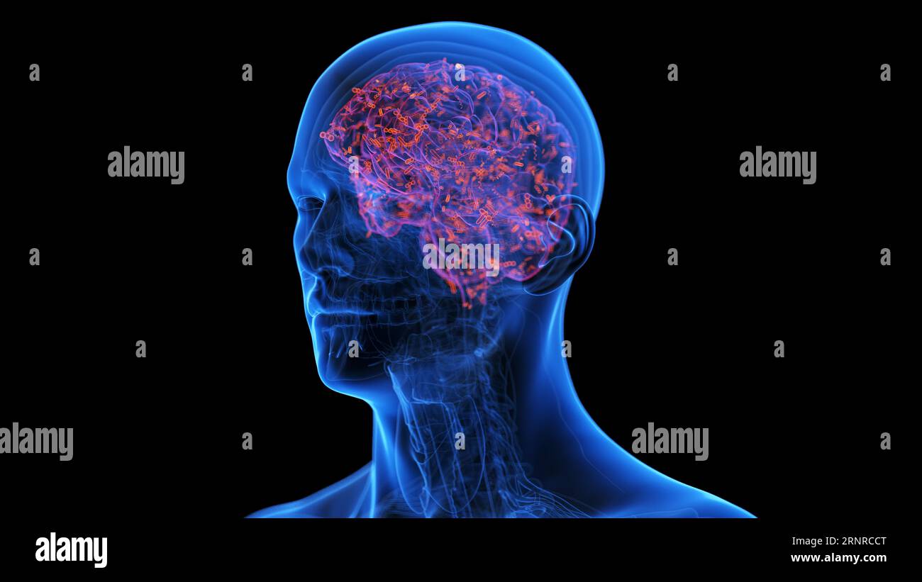 Infected human brain, illustration Stock Photo - Alamy