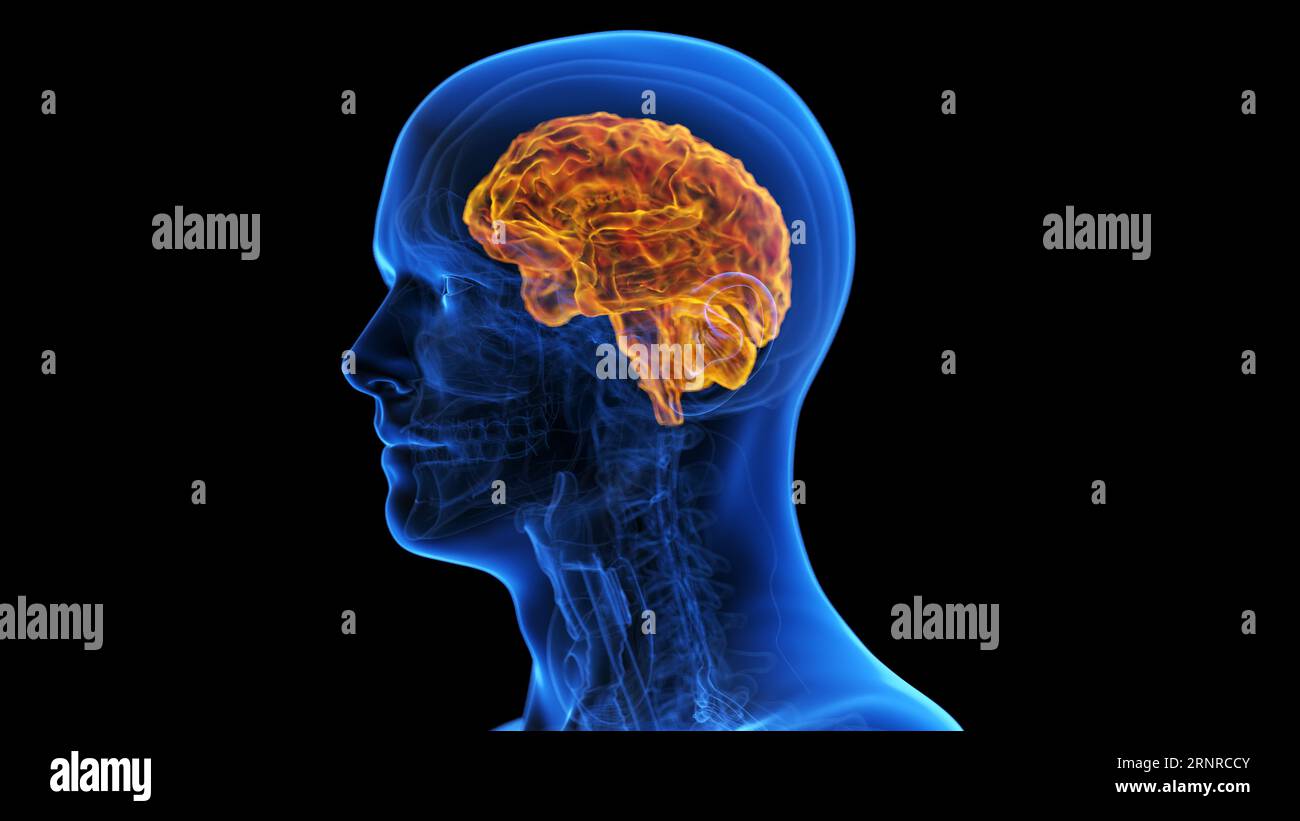Degenerated human brain, illustration Stock Photo - Alamy