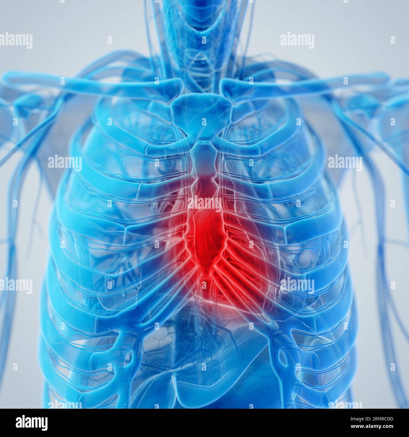 Inflamed heart hi-res stock photography and images - Alamy