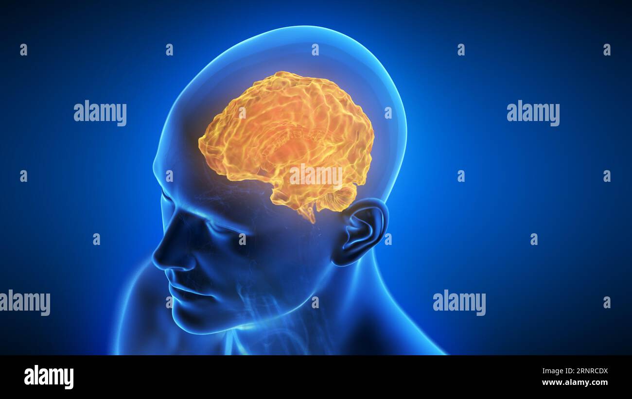 Degenerated human brain, illustration Stock Photo - Alamy