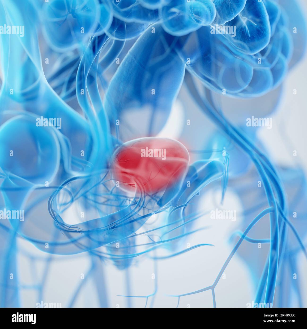 Inflamed bladder, illustration Stock Photo - Alamy