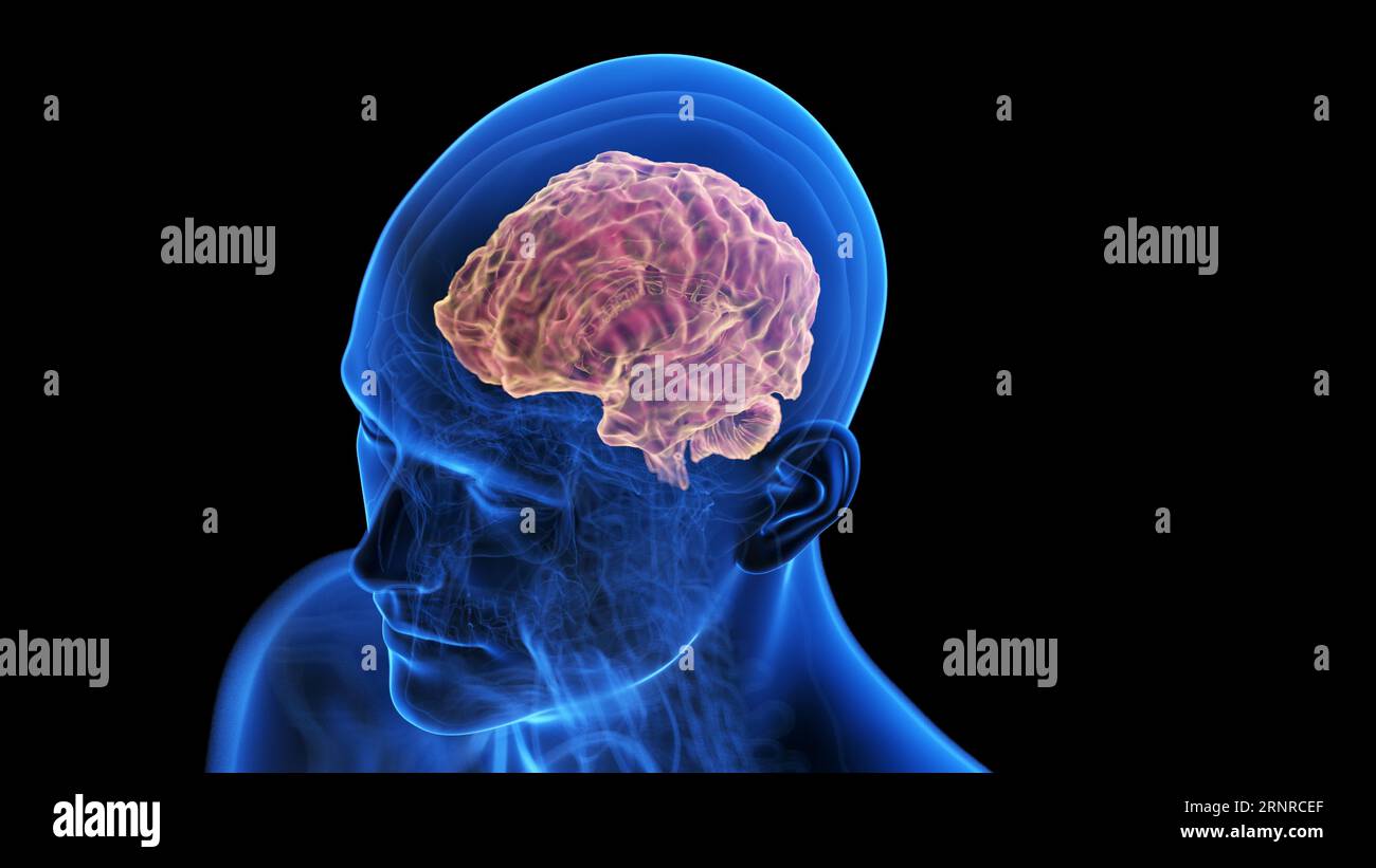Degenerated human brain, illustration Stock Photo - Alamy