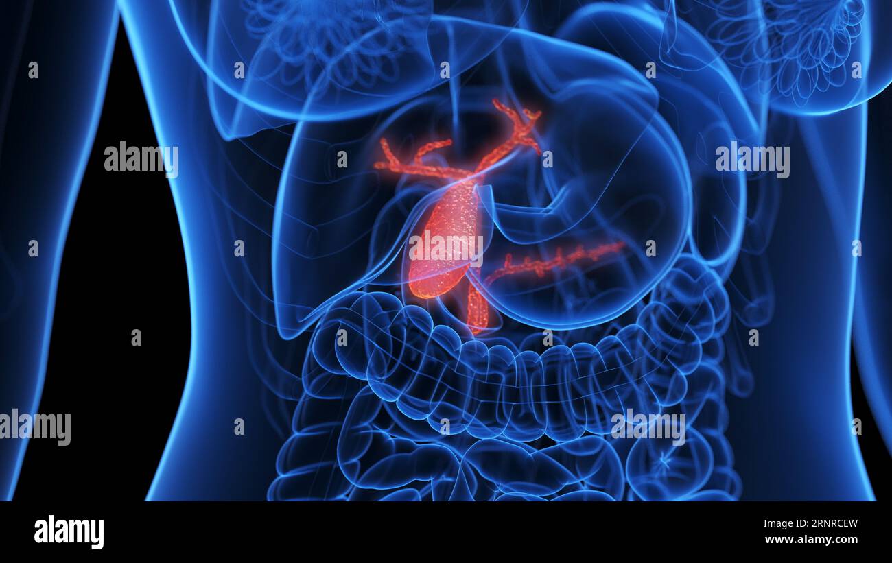 Inflamed gallbladder hi-res stock photography and images - Alamy