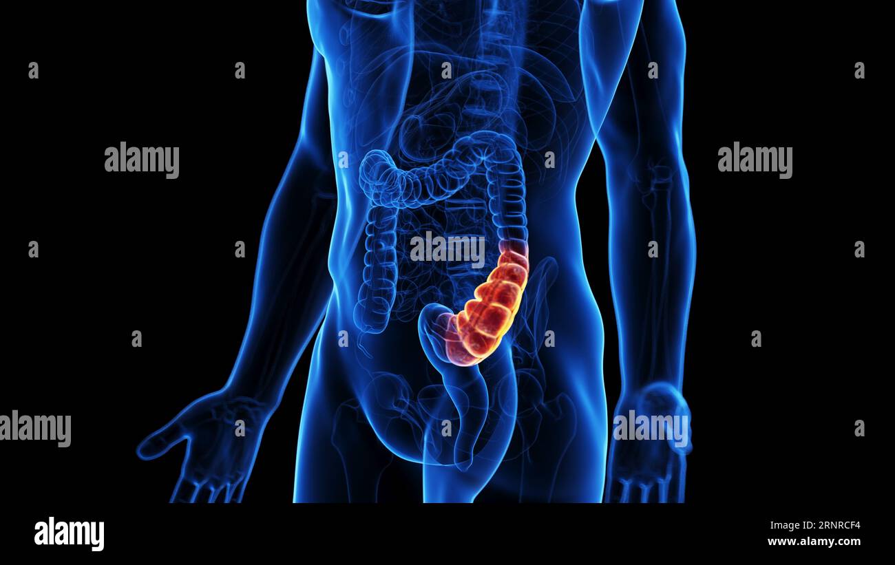 Constipated colon, illustration Stock Photo - Alamy