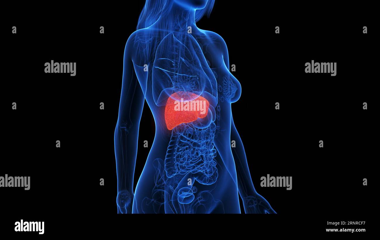 Inflamed liver, illustration Stock Photo - Alamy