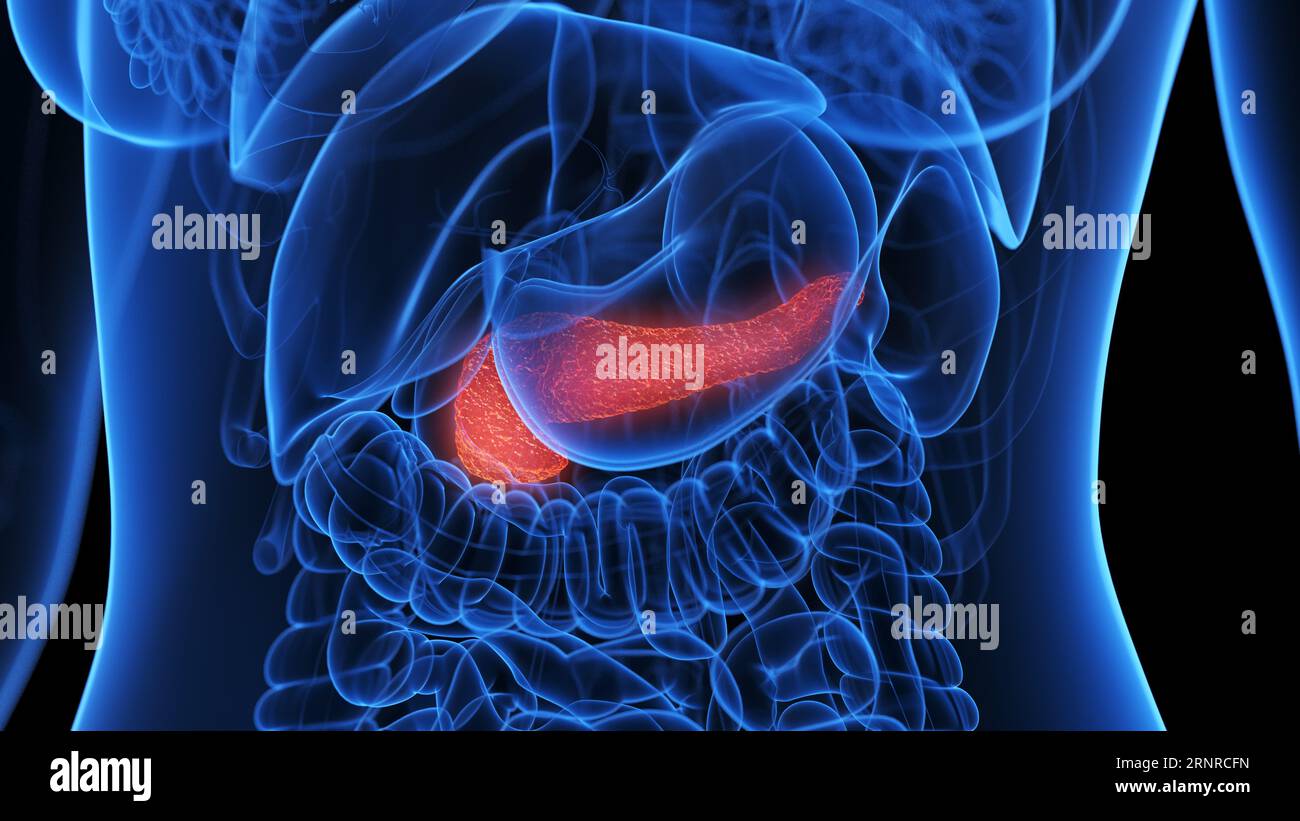 Inflamed pancreas hi-res stock photography and images - Alamy